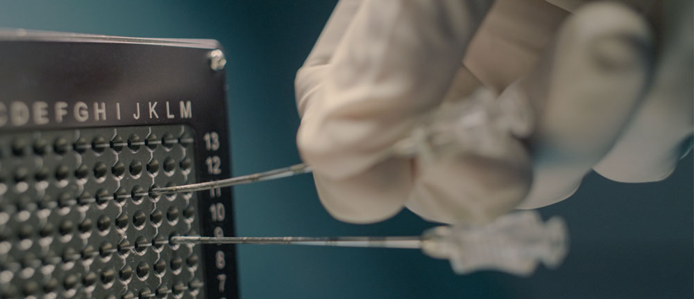 Technology – SpectraCure’s IDOSE® dose planning plattform has the ...